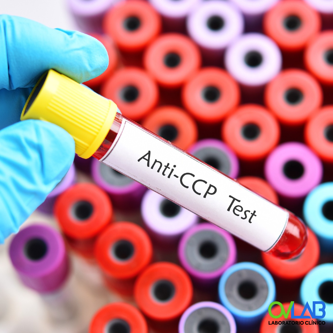 ANTI CCP P PTIDO C CLICO CITRULINADO OVLAB O V Laboratorios